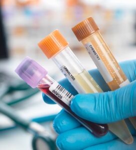 Custom Human Tissue Procurement Services | Boca Biolistics